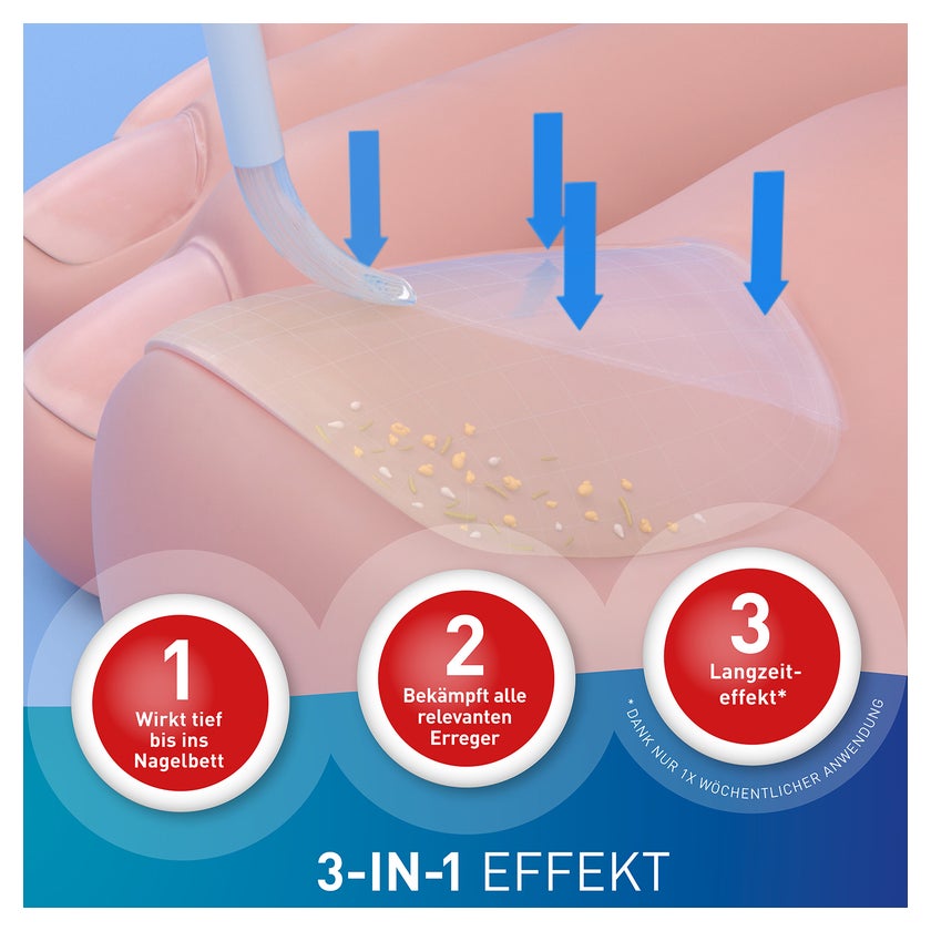 Loceryl Nagellack mit Direkt-Applikator 5 ml online kaufen | DocMorris