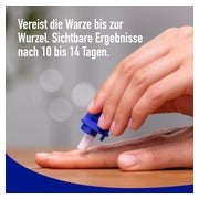 Wartner Warzen Spray 50 ml online kaufen | DocMorris