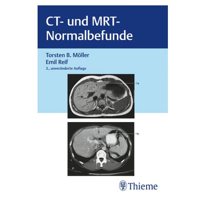 CT und MRT Normalbefunde online kaufen | DocMorris